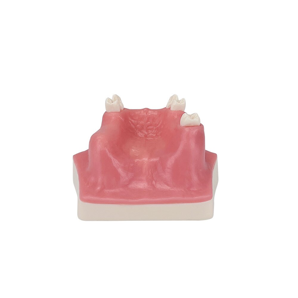 Dental Implant Teaching Model Maxillary Sinus Teeth Model for Dentist ...